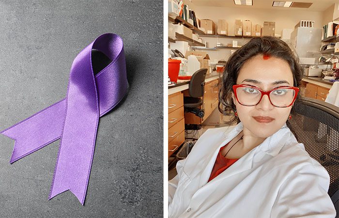 Antibody Invented At Charlotte Shows Promise For Pancreatic Cancer ... Antibody Invented At Charlotte Shows Promise For Pancreatic Cancer ...